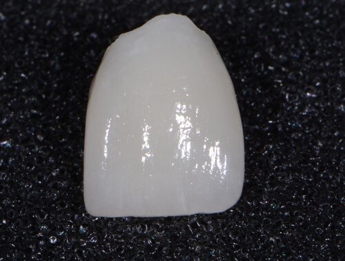 JTL Dental Lab's photo gallery of cosmetic dental restorations.